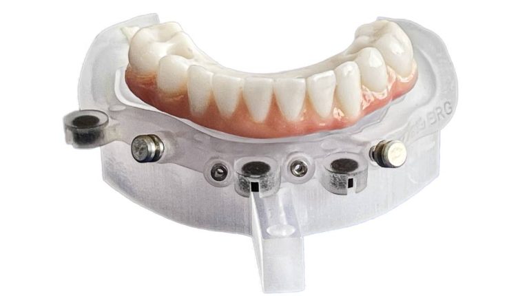 All-on-X Full-Arch Guided Surgery (GFMR & GFMP) - 3DDX