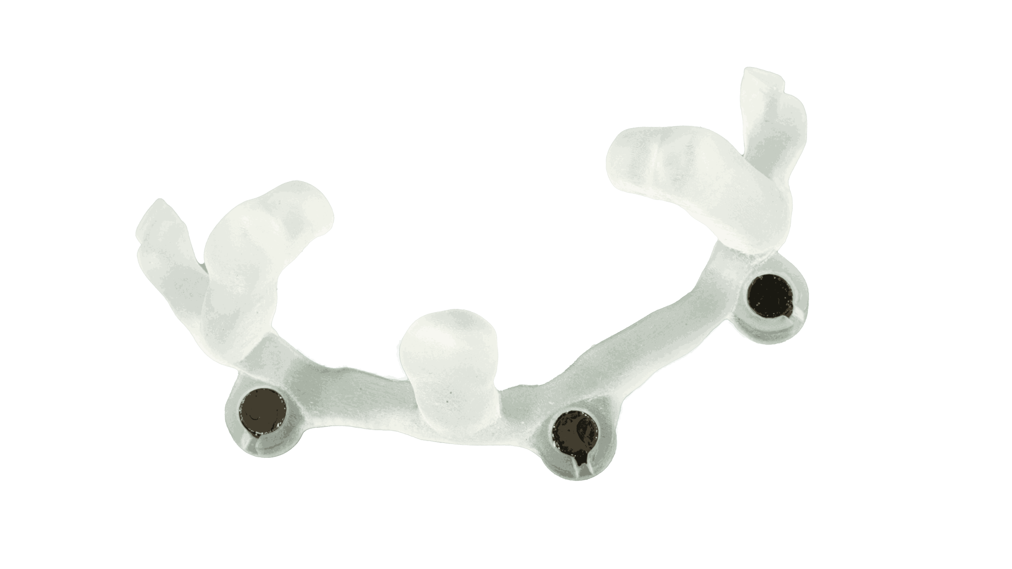What Is a Stackable Surgical Guide and When Do You Need One? - 3DDX